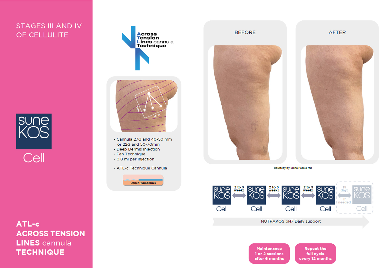 Sunekos Cell 10ml | Professional Dietetics | Mayorista Aesthetic Pharma